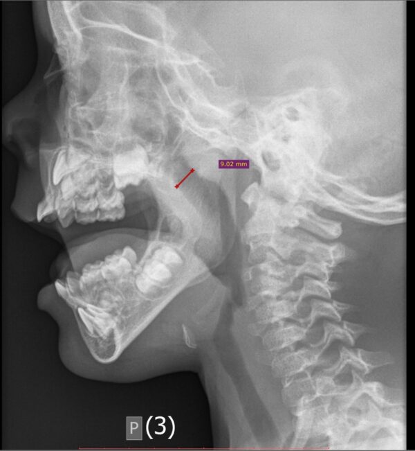 SZYBKIE I CIĄGŁE odsłuchiwanie - bez klikania - cała rozmowa o trzecim ...